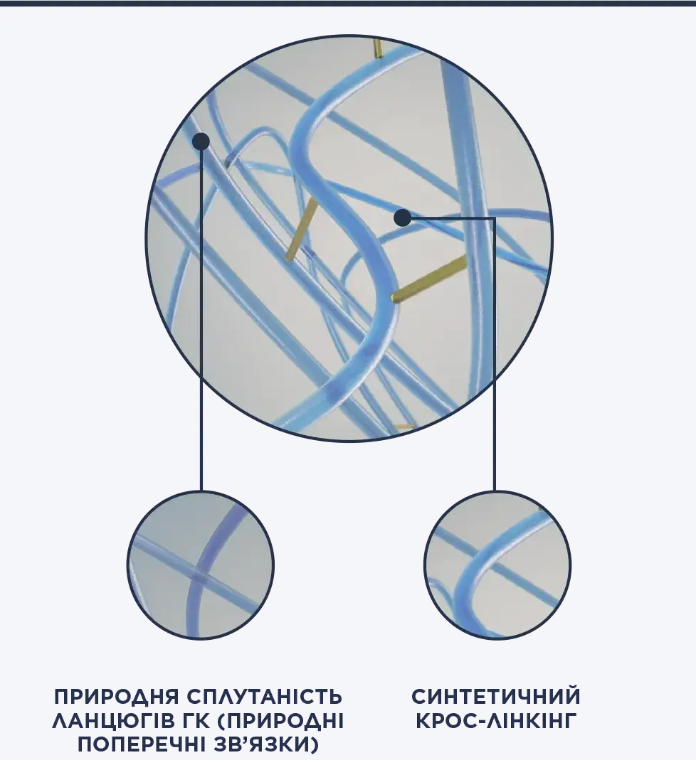 Технології NASHA \ OBT | Restylane